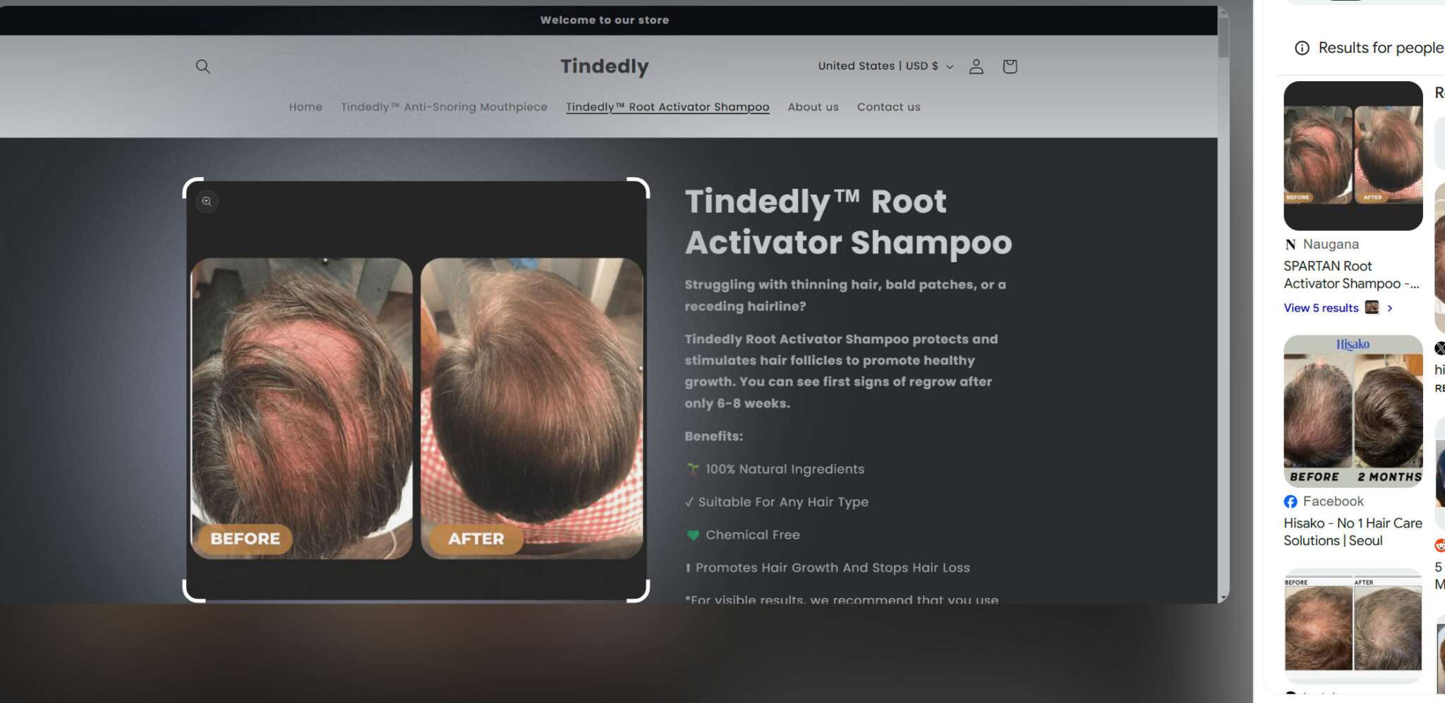 Tindedly Root Activator Shampoo - Scam Or Legit? Read This